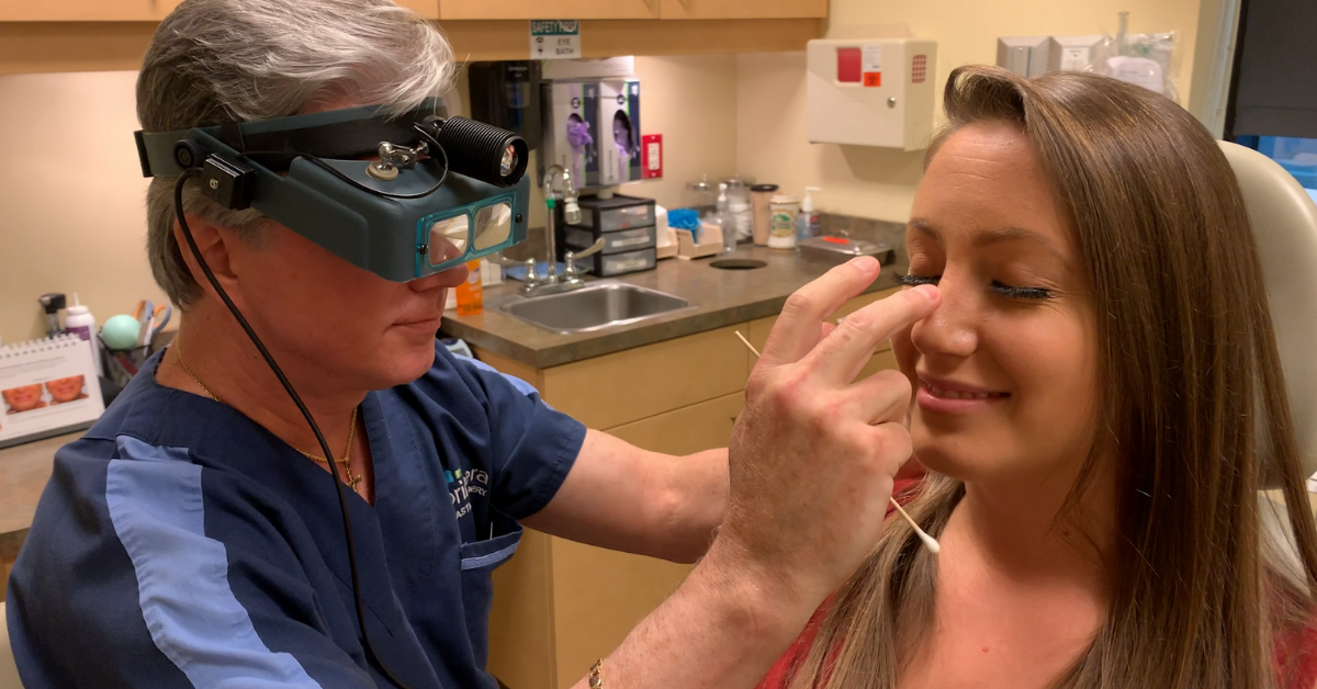 What Is a Nose Thread Lift or String Rhinoplasty? – Primera Plastic Surgery