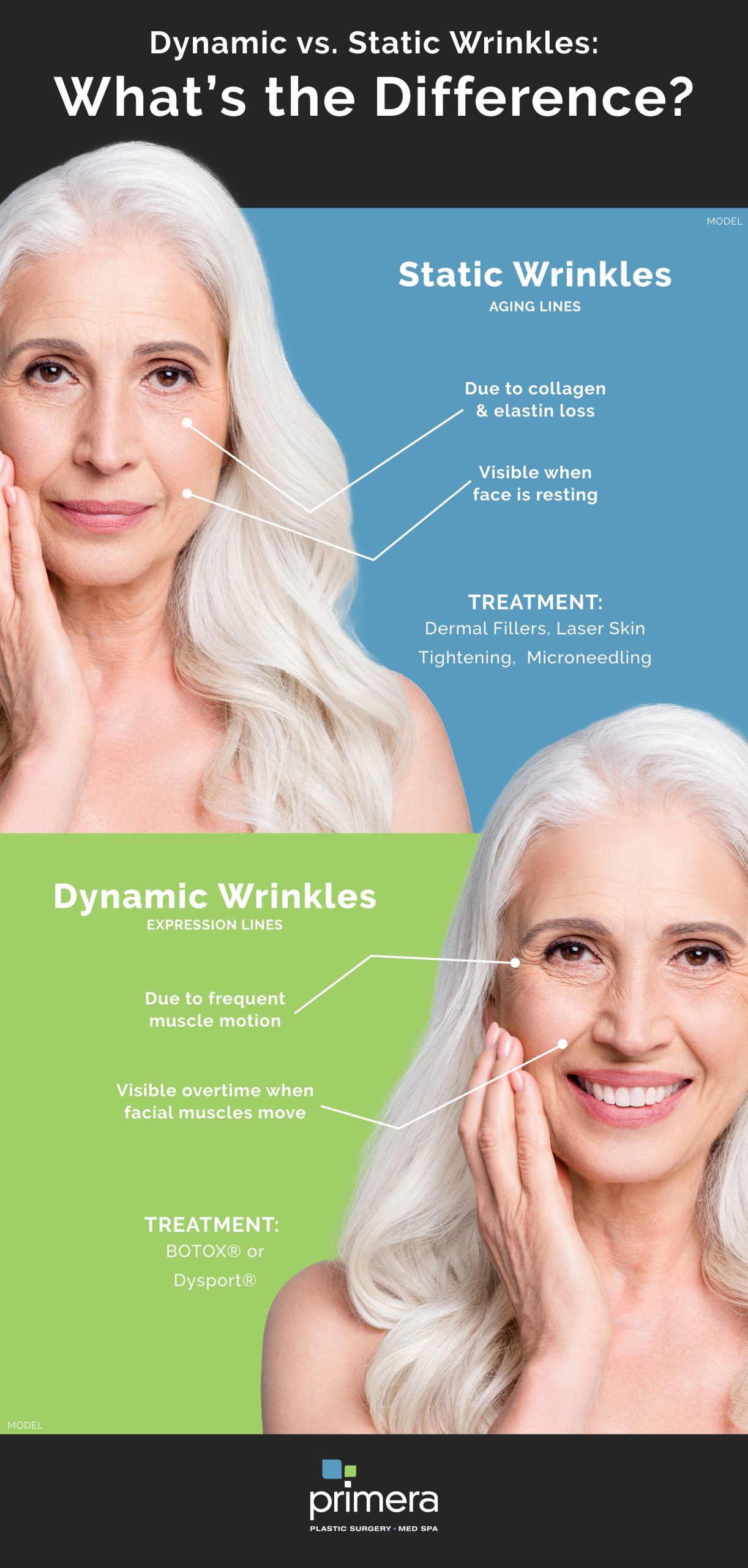Dynamic vs. Static Wrinkles: What’s the Difference? (INFOGRAPHIC) – Primera Plastic Surgery